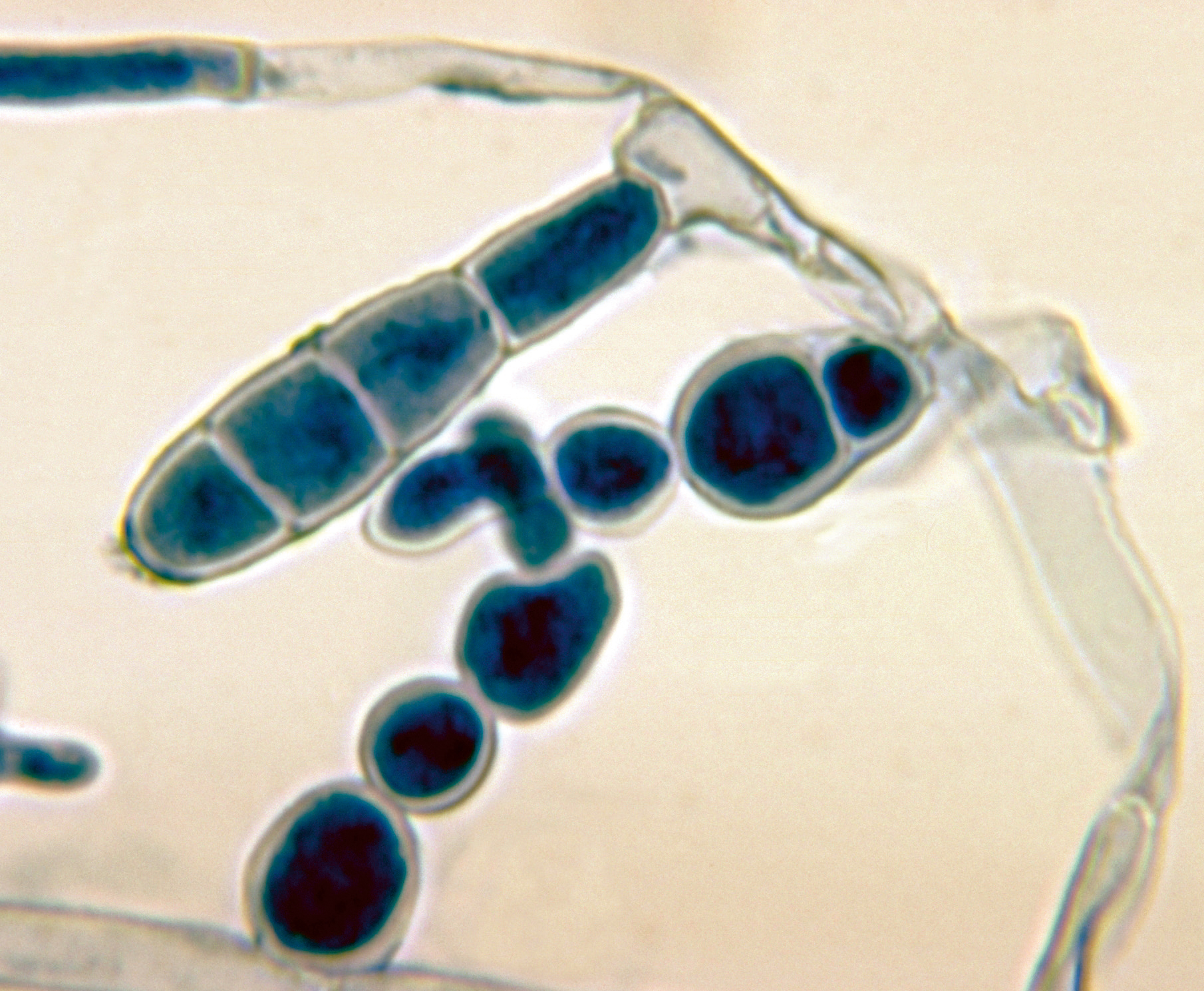 Epidermophyton in "Dizionario di Medicina"