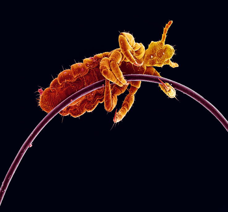 pediculosi in "Dizionario di Medicina"