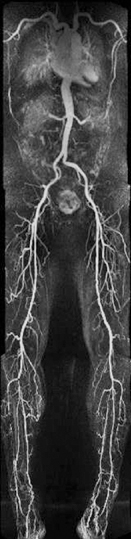 RMN (sigla di Risonanza Magnetica Nucleare) in "Dizionario di Medicina"