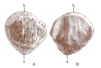 rotula nell'Enciclopedia Treccani