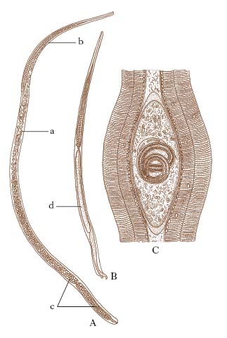 Trichinella nell'Enciclopedia Treccani