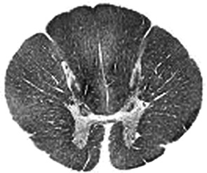 neuromero in "Dizionario di Medicina"